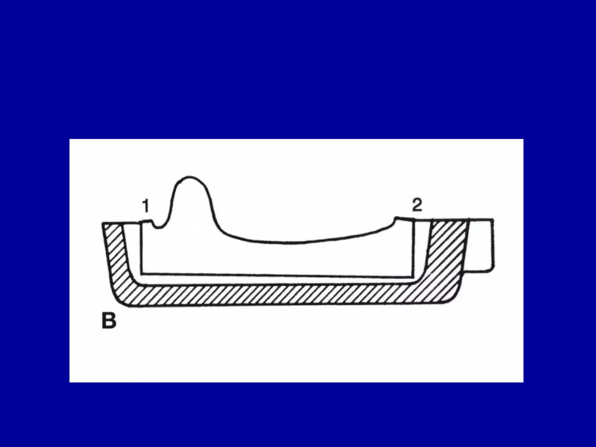 11.complete denture wax‐up and flasking procedure | PPT