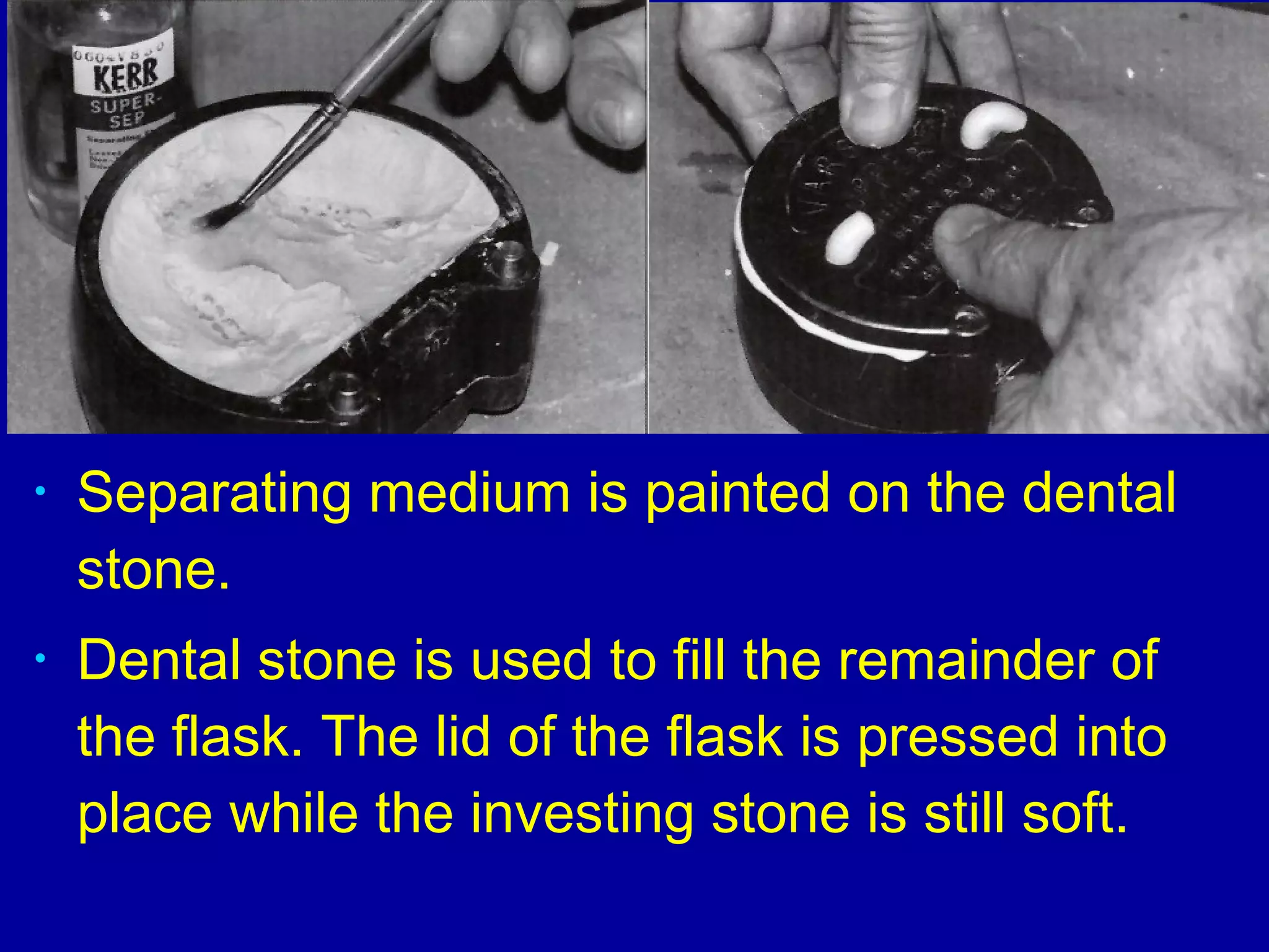 11.complete denture wax‐up and flasking procedure | PPT