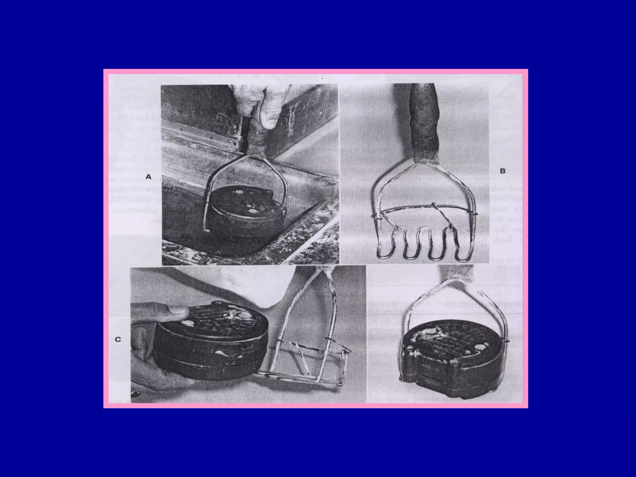 11.complete denture wax‐up and flasking procedure | PPT