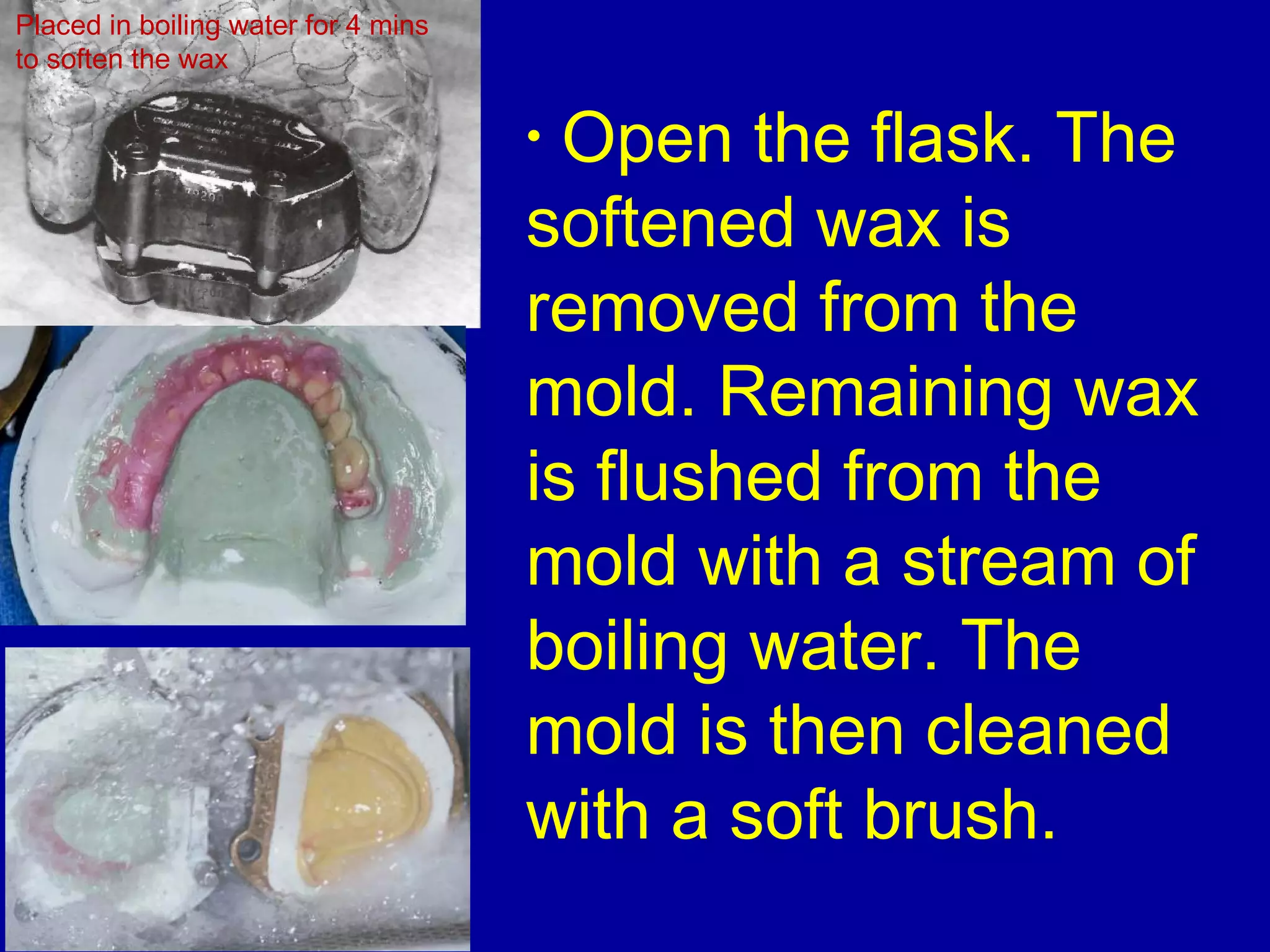 11.complete denture wax‐up and flasking procedure | PPT