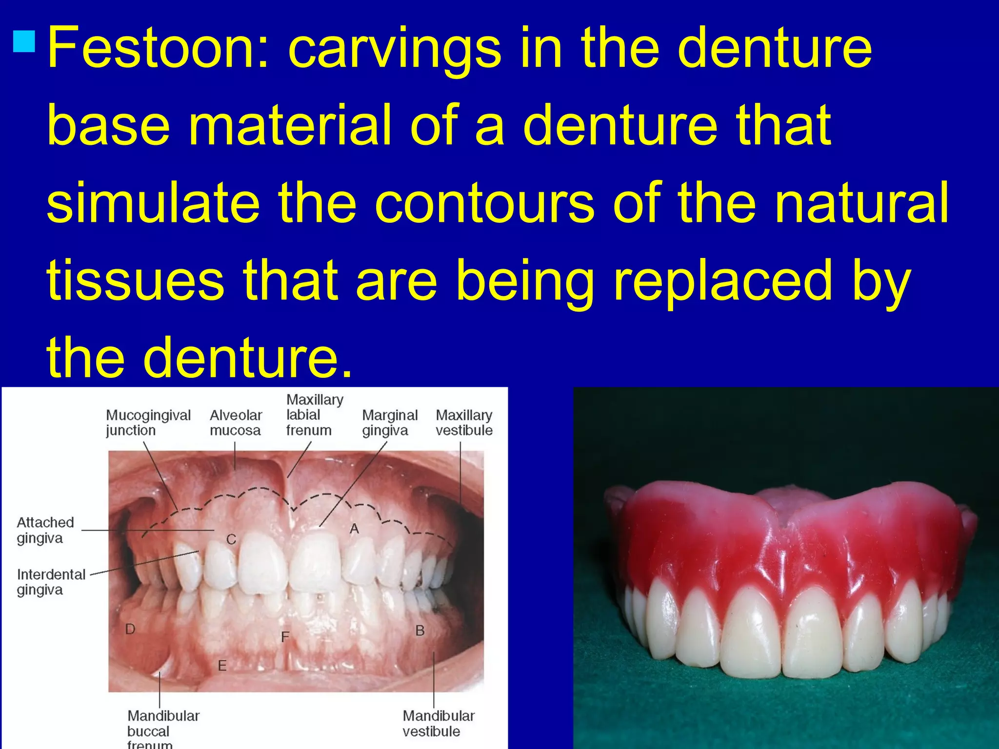 11.complete denture wax‐up and flasking procedure | PPT