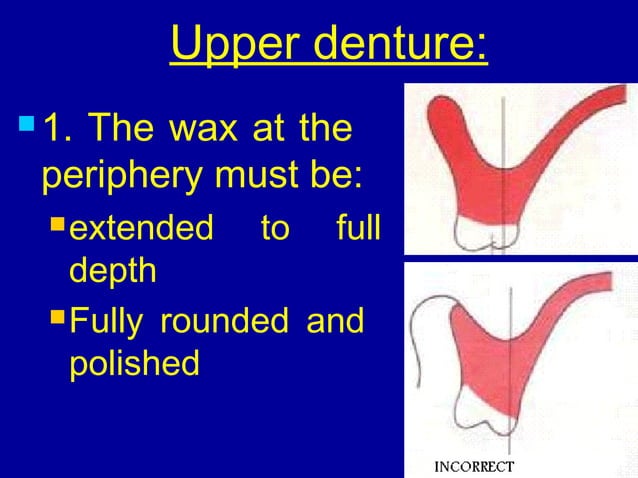 11.complete denture wax‐up and flasking procedure | PPT