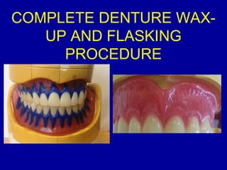11.complete denture wax‐up and flasking procedure | PPT