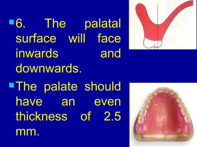 11.complete denture wax‐up and flasking procedure | PPT