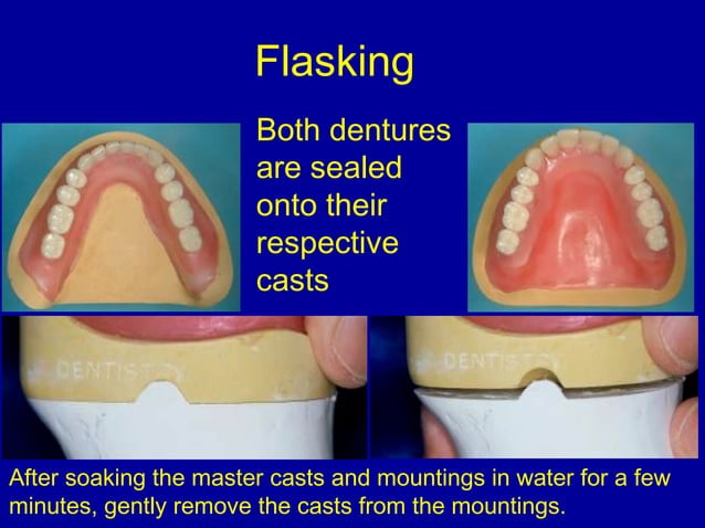 11.complete denture wax‐up and flasking procedure | PPT