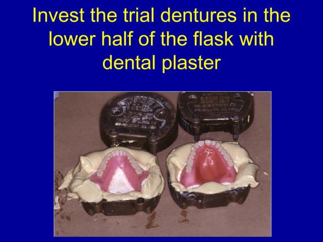 11.complete denture wax‐up and flasking procedure | PPT