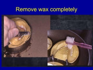11.complete denture wax‐up and flasking procedure | PPT