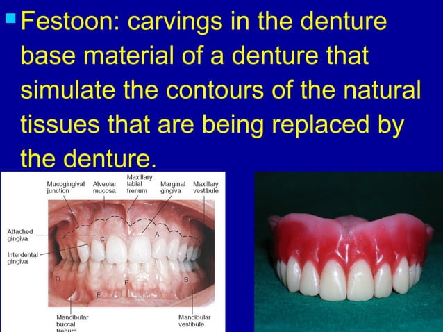 11.complete denture wax‐up and flasking procedure | PPT