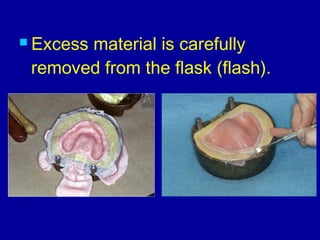 11.complete denture wax‐up and flasking procedure | PPT