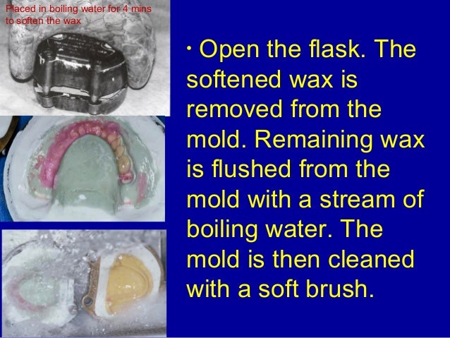 11.complete denture wax‐up and flasking procedure