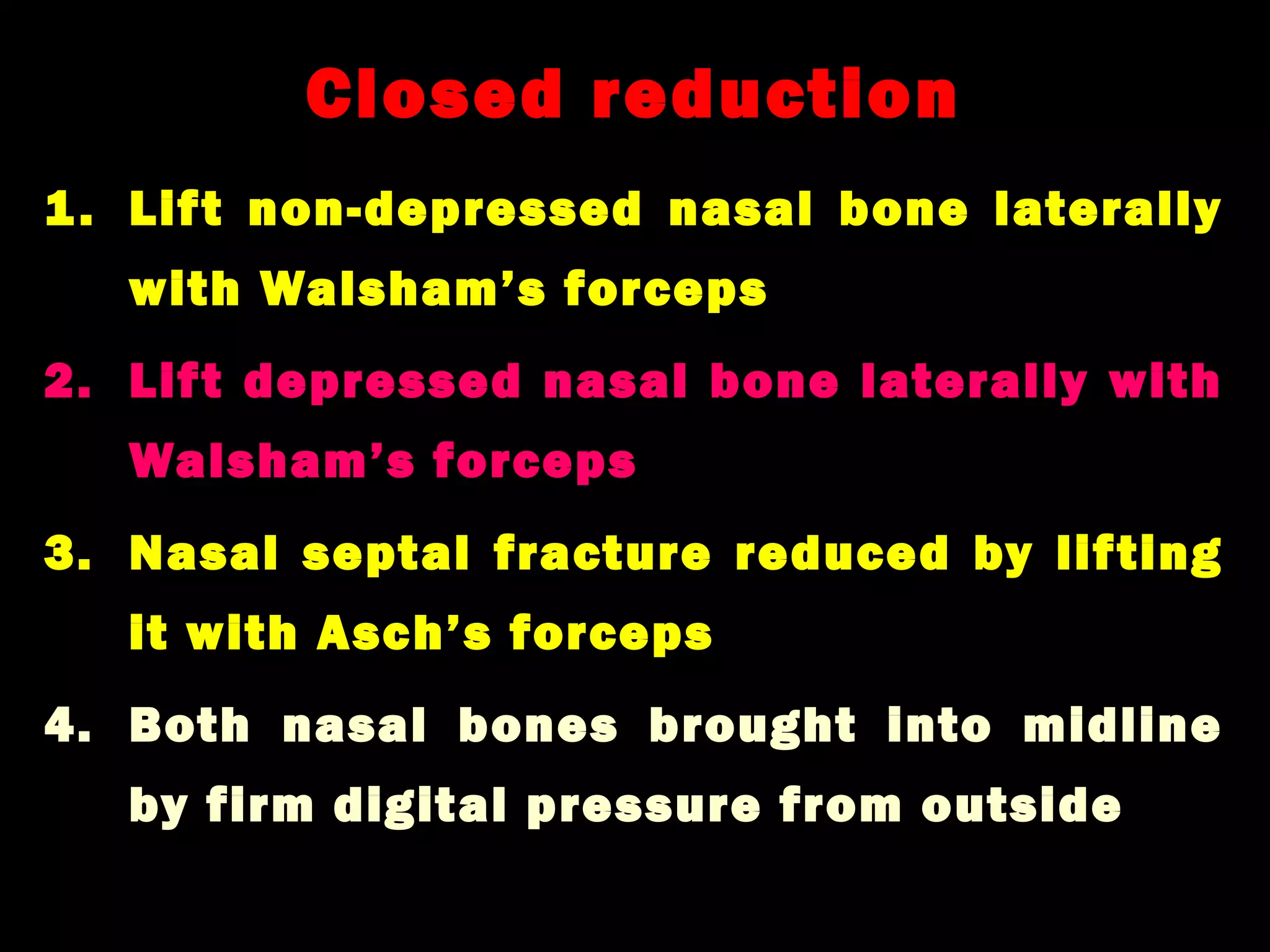 Facial bone fractures | PPT