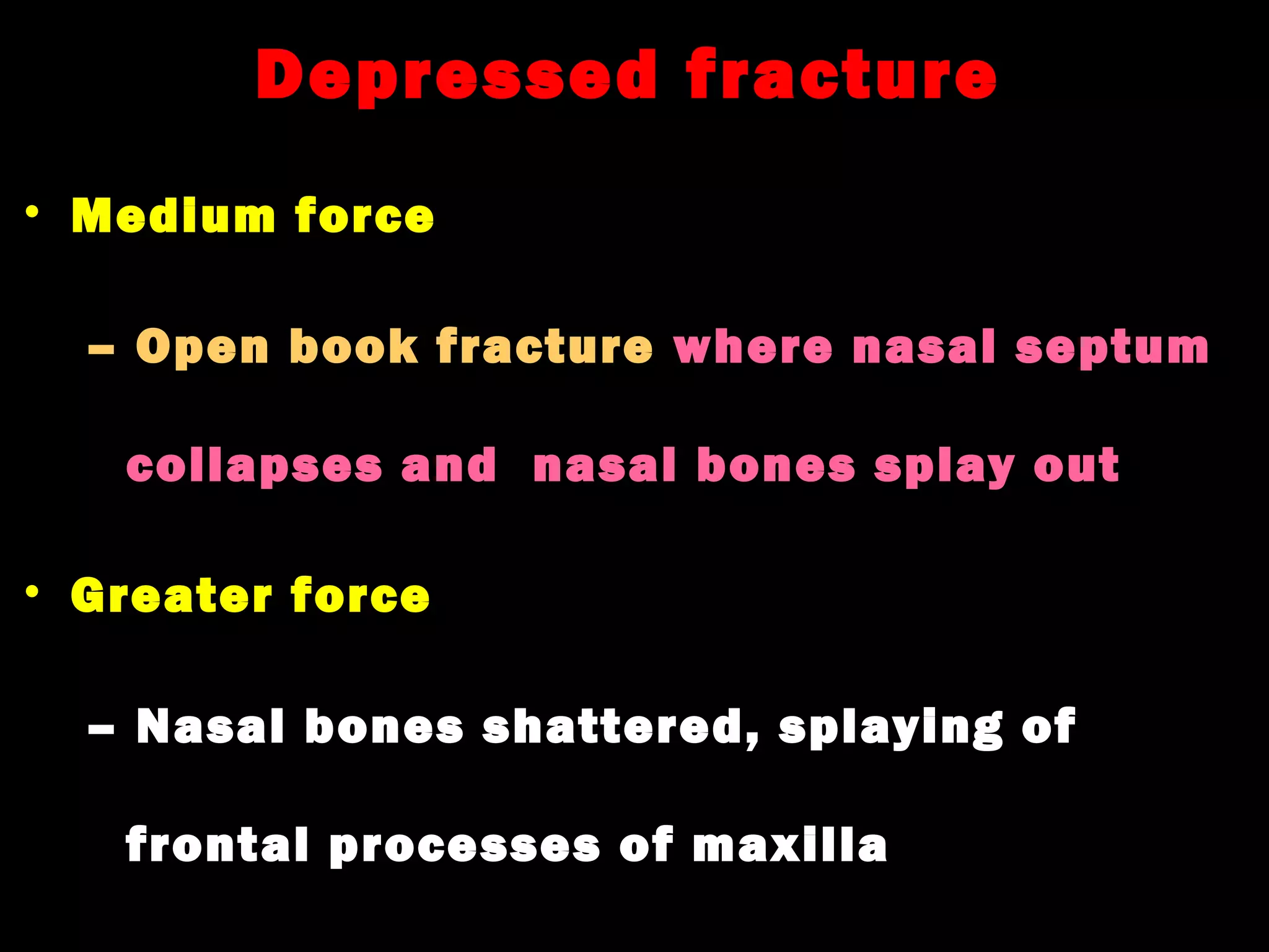 Facial bone fractures | PPT