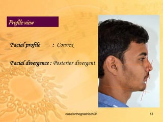 Dr. RAHUL VC TIWARI, SIBAR INSTITUTE OF DENTAL SCIENCES, GUNTUR, ANDHRA ...