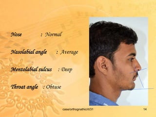 Dr. RAHUL VC TIWARI, SIBAR INSTITUTE OF DENTAL SCIENCES, GUNTUR, ANDHRA ...