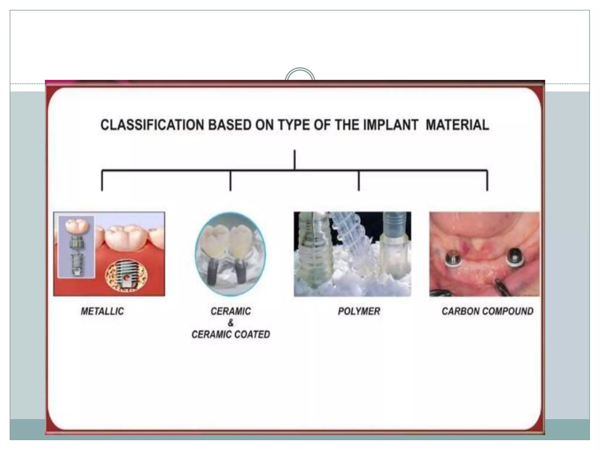 Basic aspects of implants | PPTX