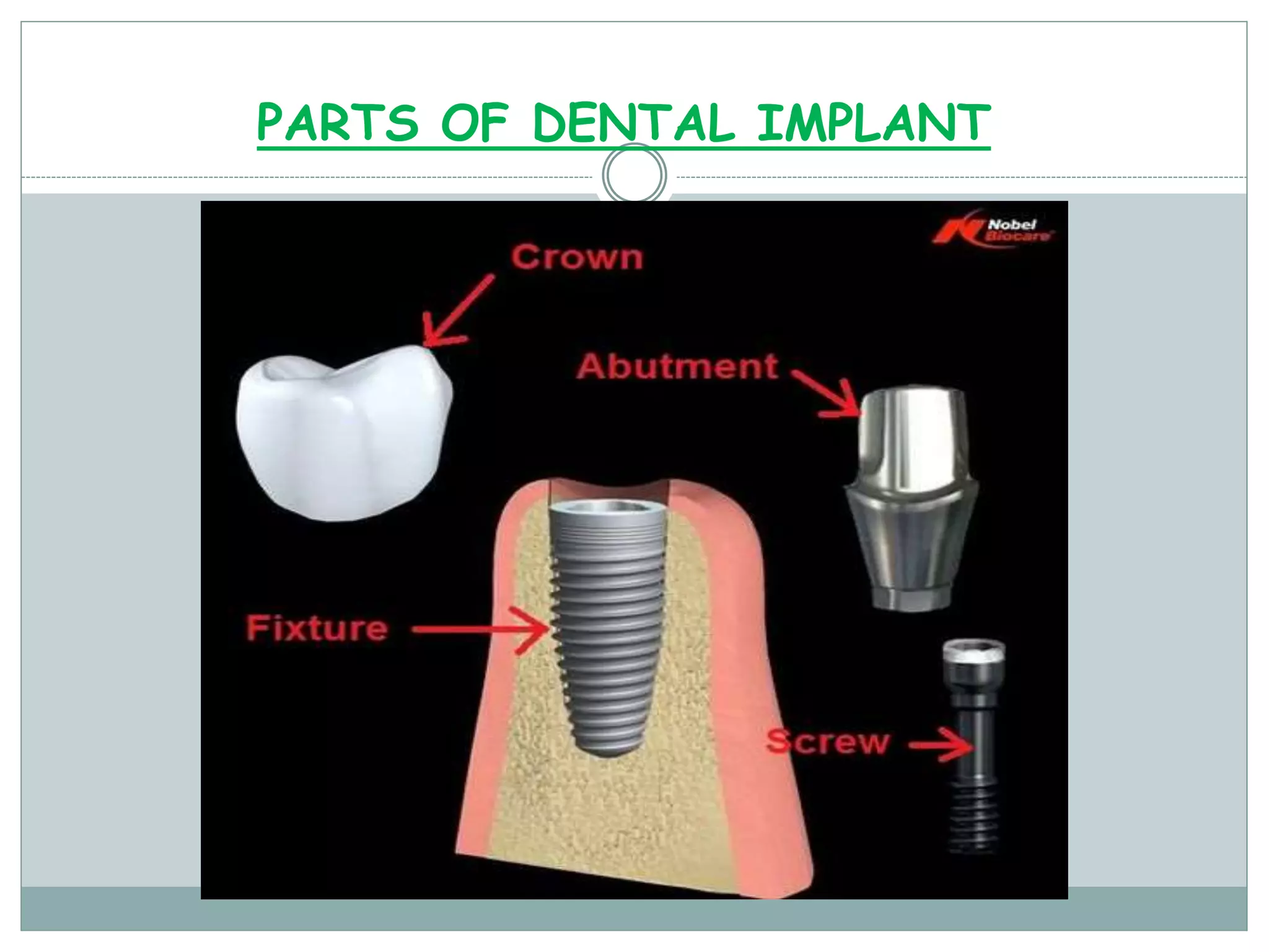 Basic aspects of implants | PPTX