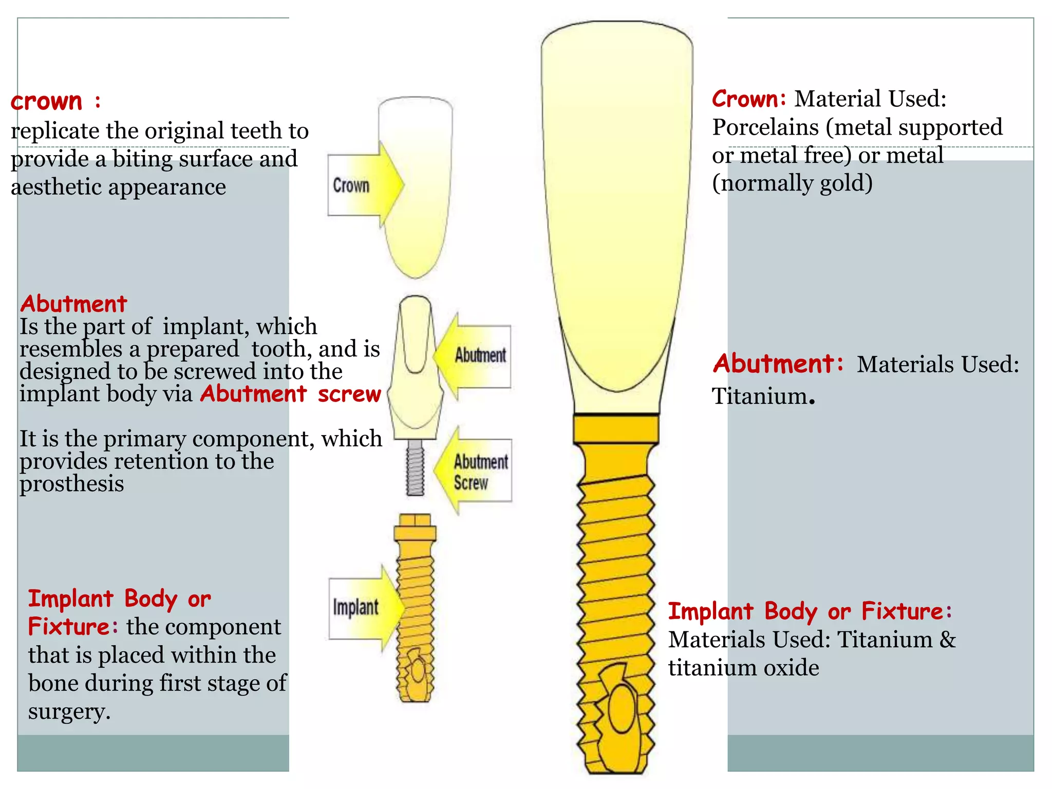 Basic aspects of implants | PPTX
