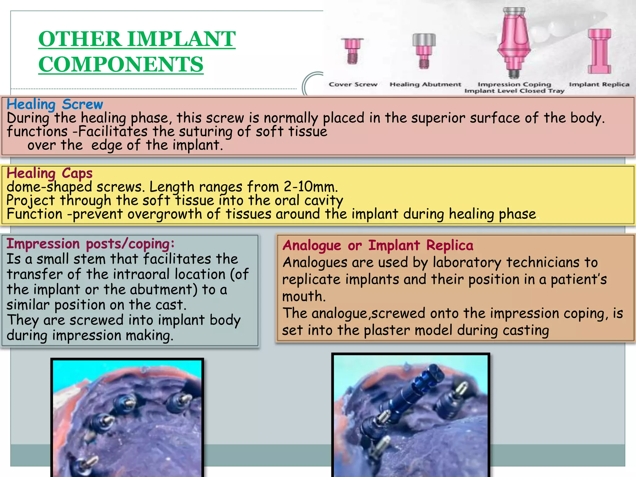Basic aspects of implants | PPTX