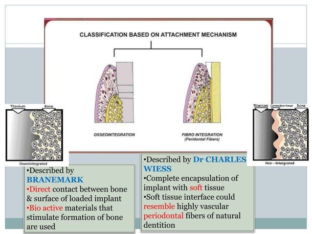 Basic aspects of implants | PPTX