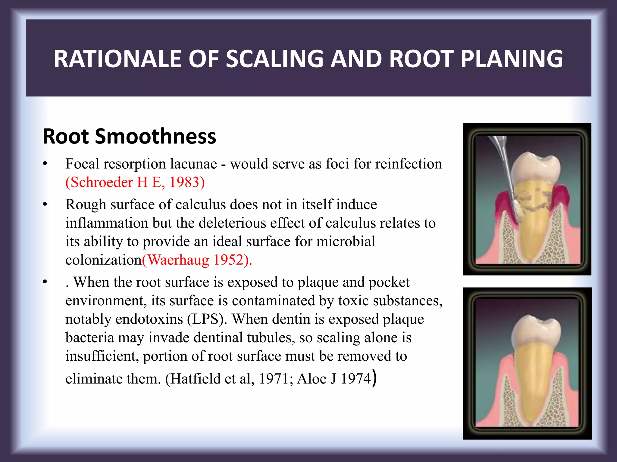 11.scaling and root planing | PPTX