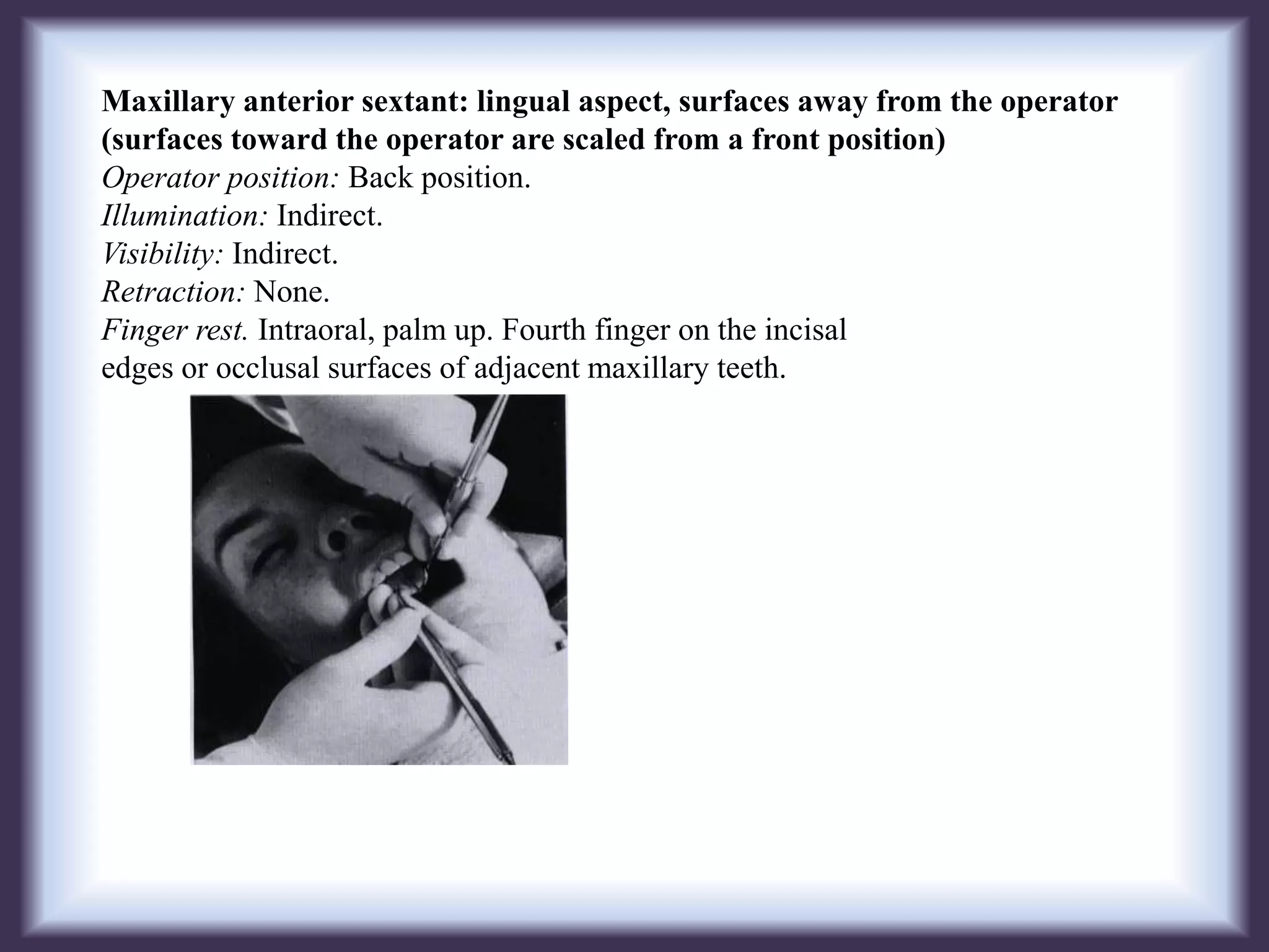 11.scaling and root planing | PPTX