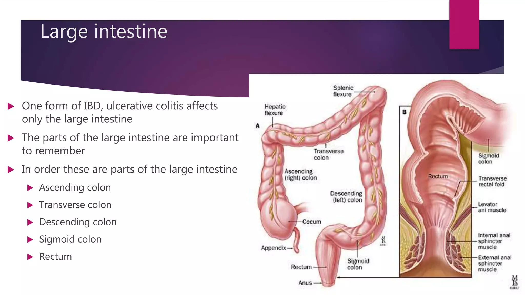 Ulcerative Colitis (IBD) | PPTX