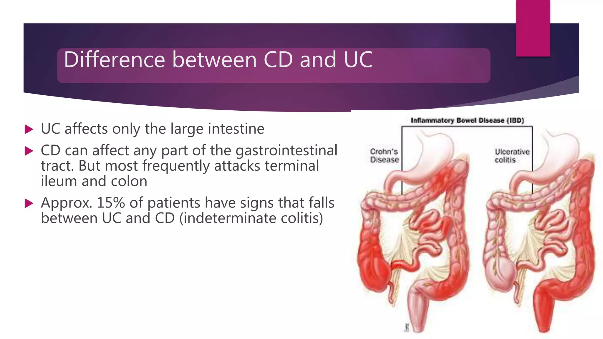 Ulcerative Colitis (IBD) | PPTX
