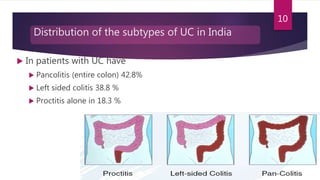 Ulcerative Colitis (IBD) | PPTX