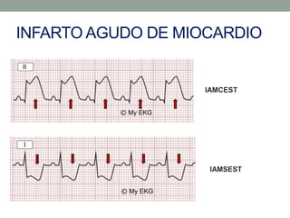 11 Algoritmo Electrocardiograma Pptx