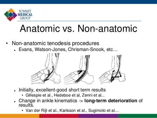Ankle Instability and Pain