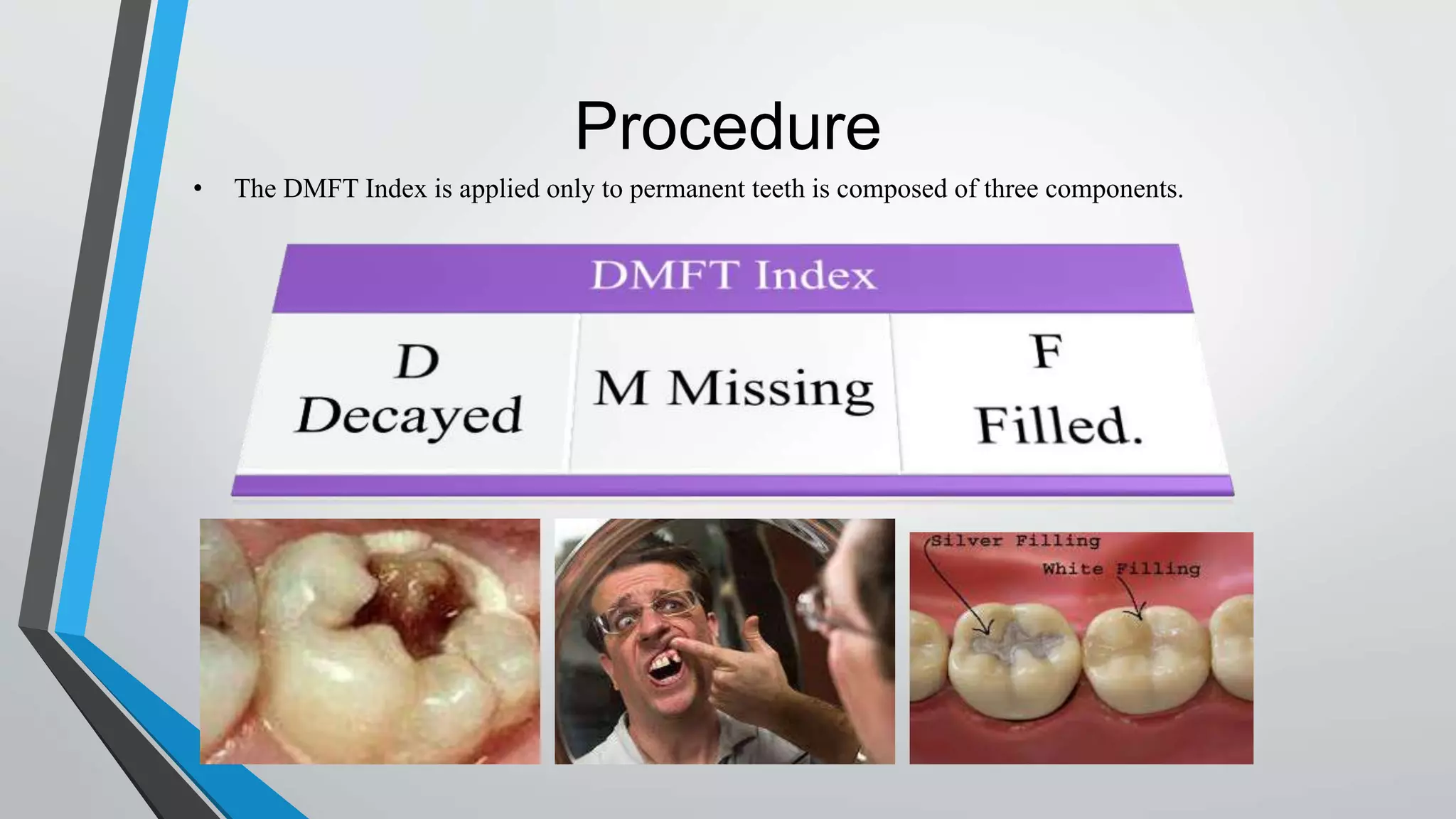 DENTAL CARIES - INDICES | PPTX