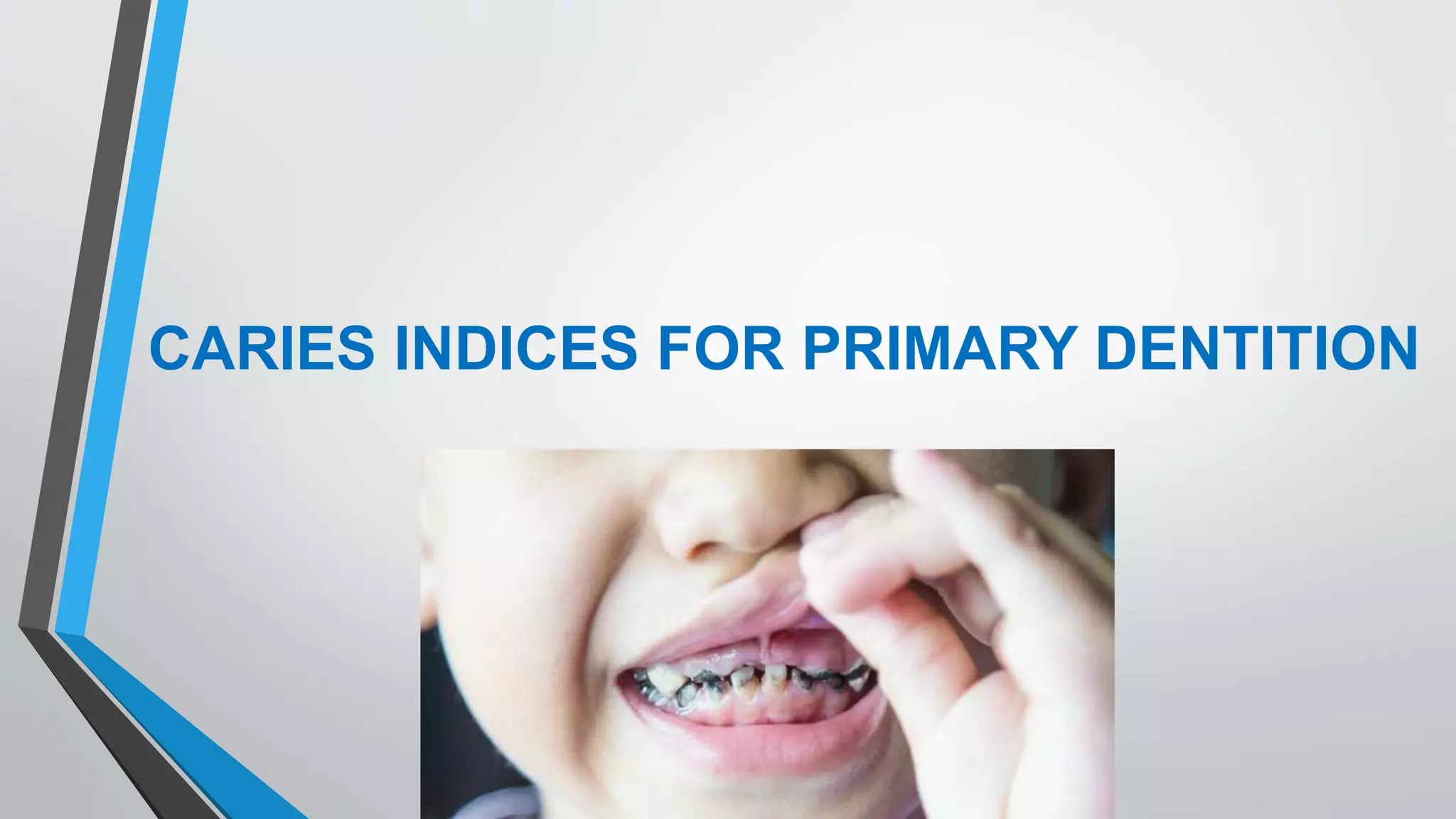 DENTAL CARIES - INDICES | PPTX