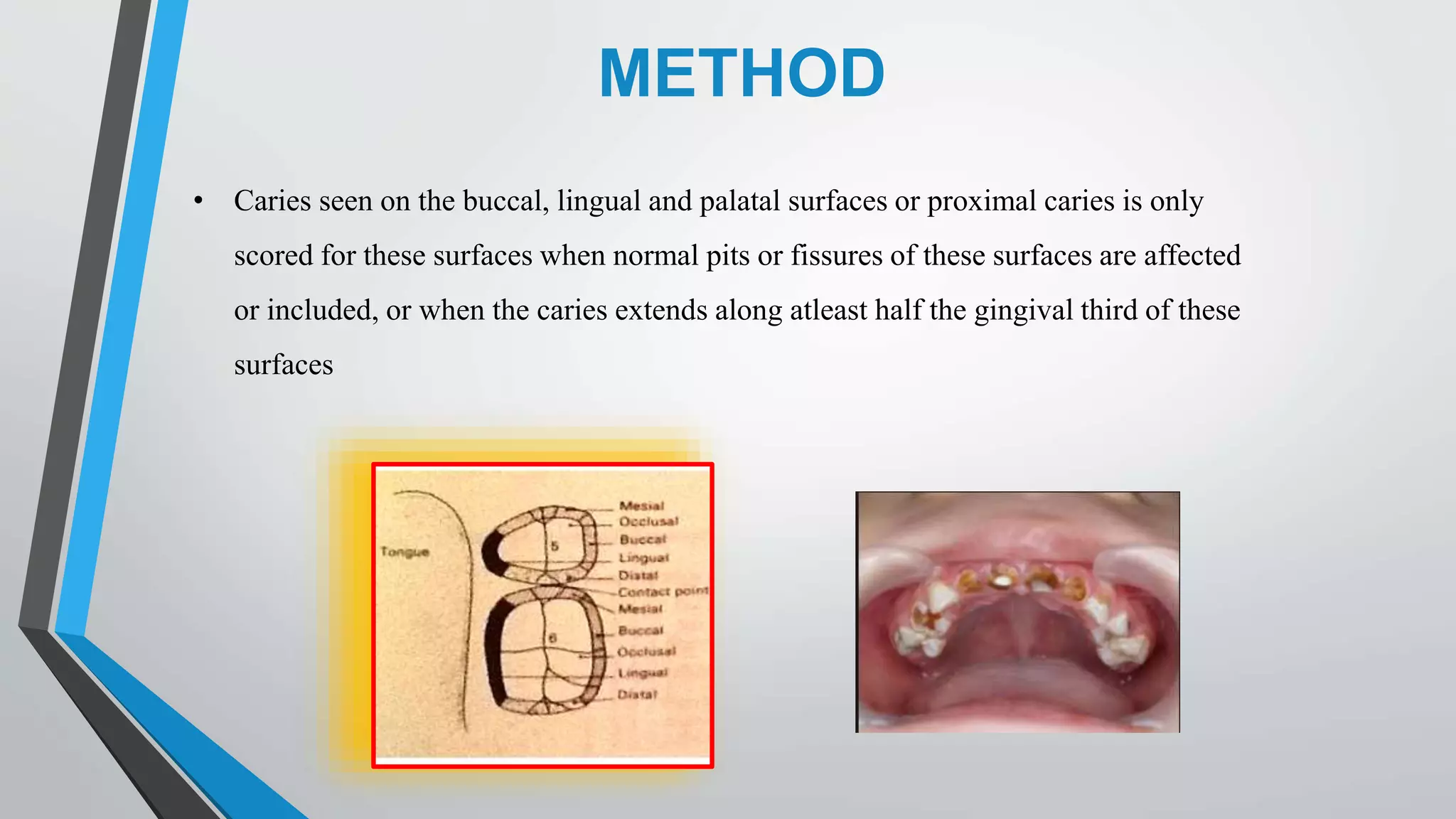 DENTAL CARIES - INDICES | PPTX
