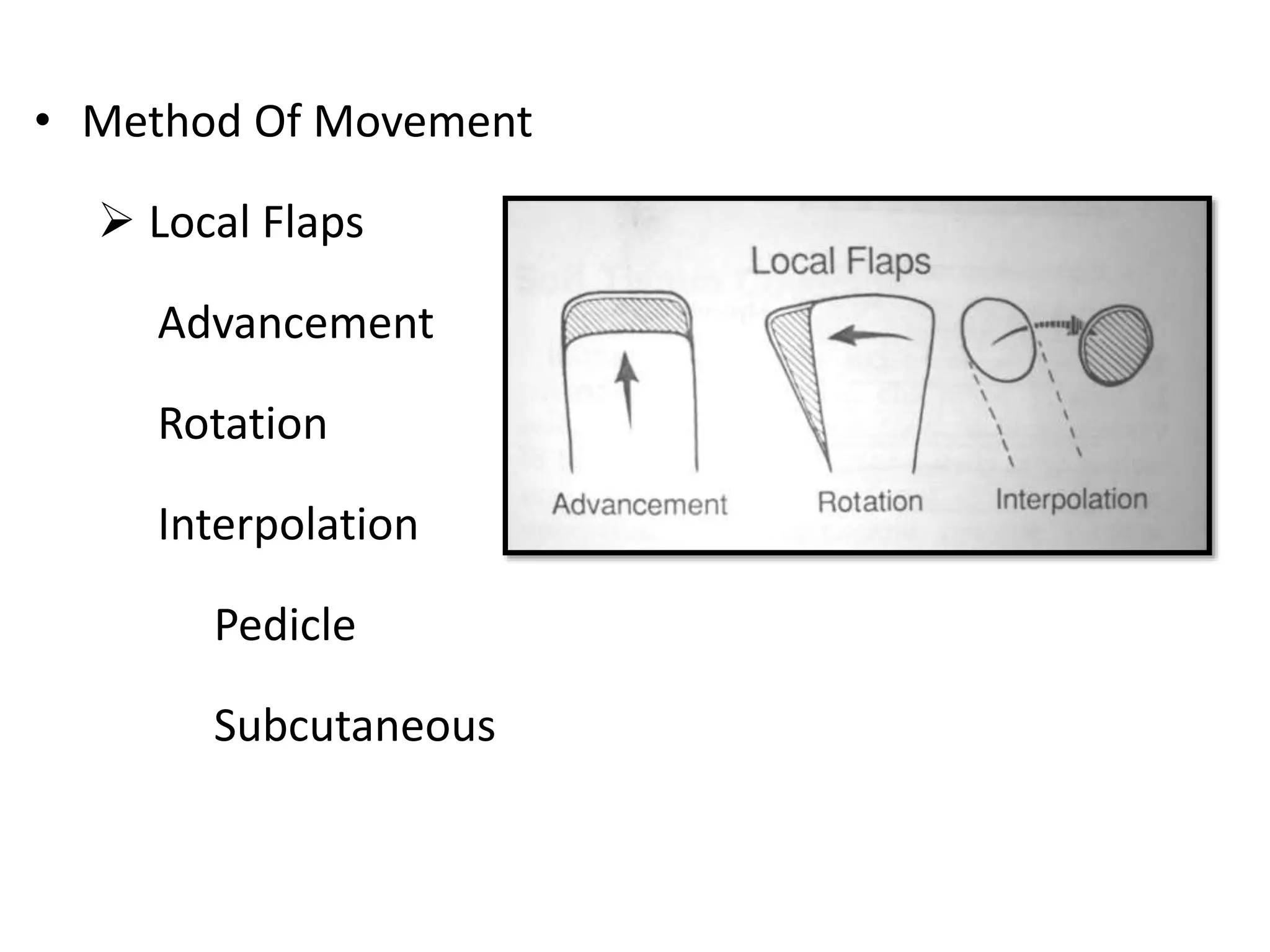 local reconstruction flaps in maxillofacial surgery | PPTX