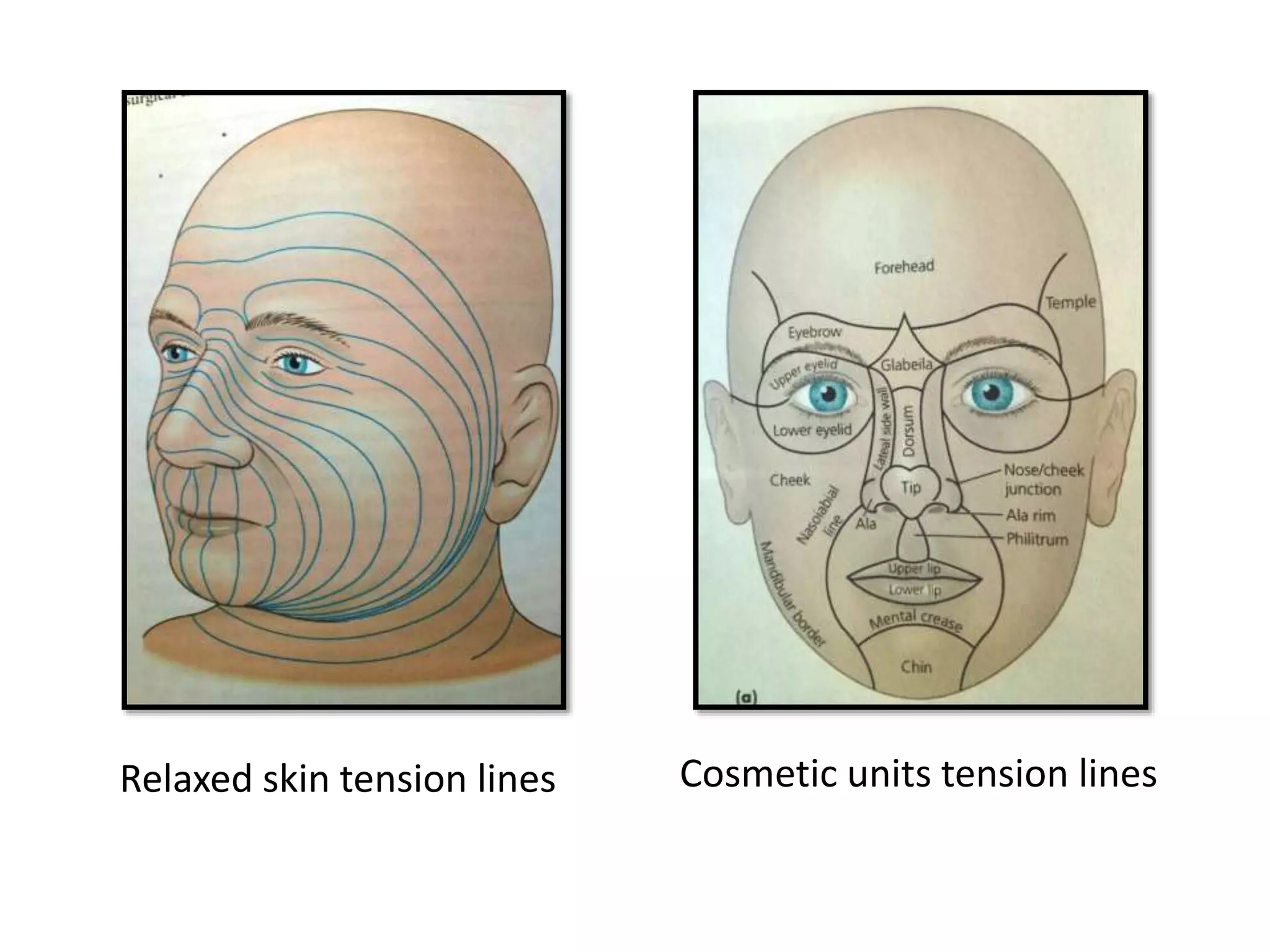local reconstruction flaps in maxillofacial surgery | PPTX