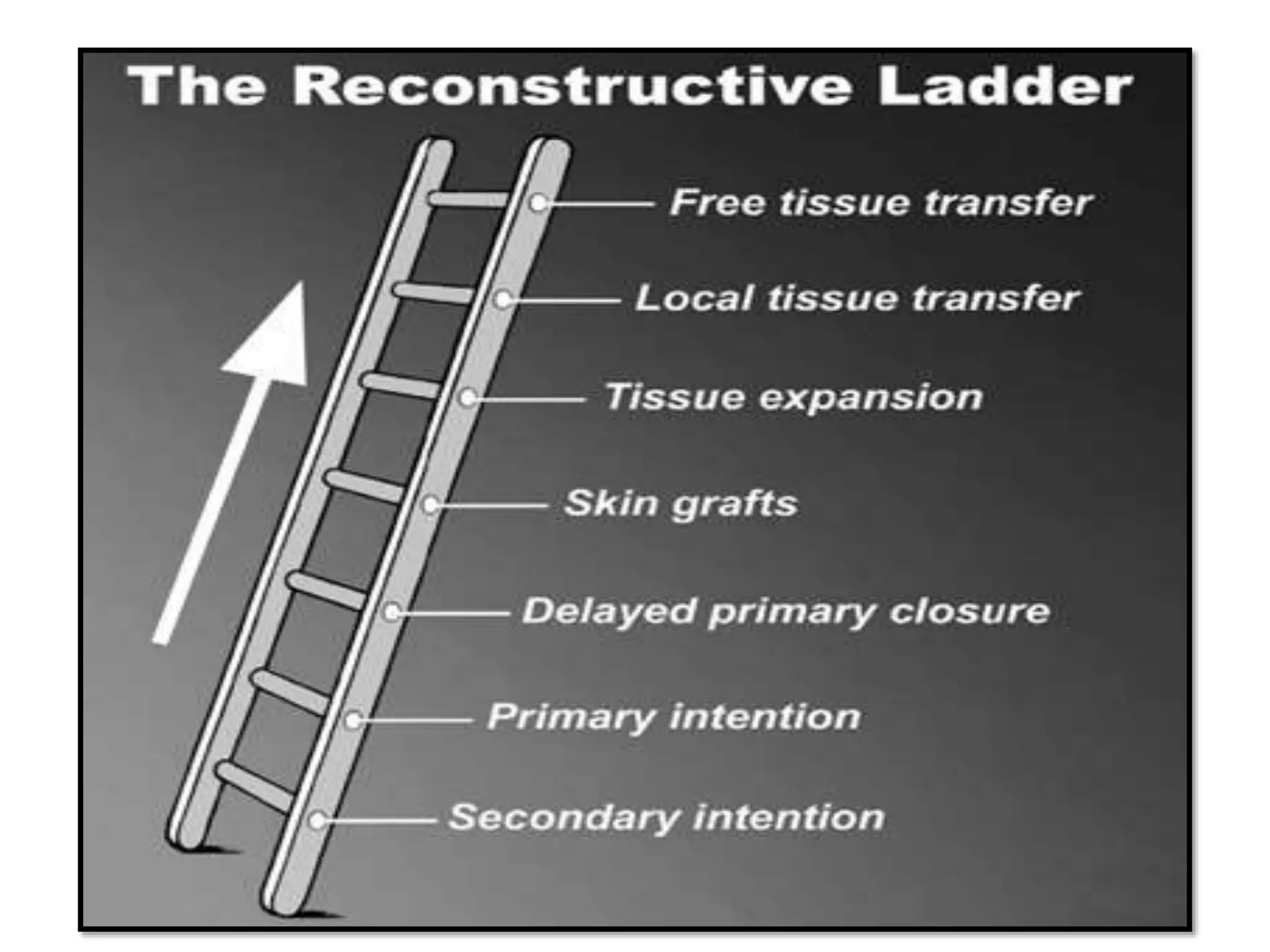 local reconstruction flaps in maxillofacial surgery | PPTX