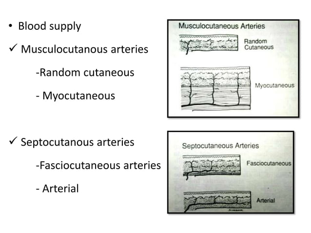 local reconstruction flaps in maxillofacial surgery | PPTX | First Aid ...