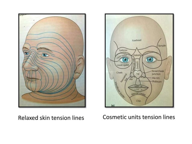 local reconstruction flaps in maxillofacial surgery | PPTX | First Aid ...