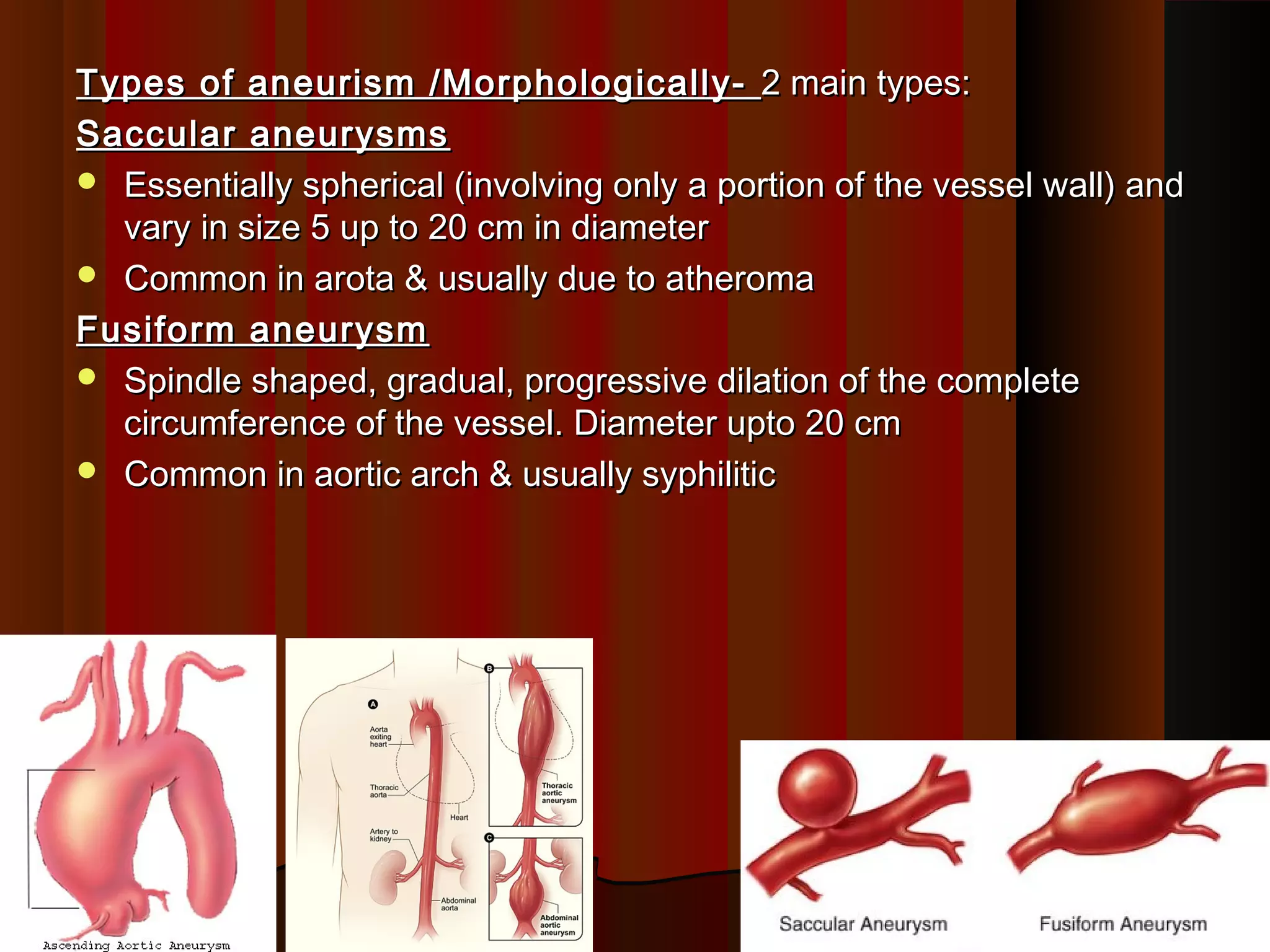 11.Vascular pathology | PPT