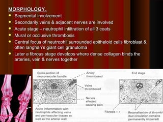 11.Vascular pathology | PPT