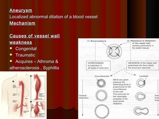 11.Vascular pathology | PPT