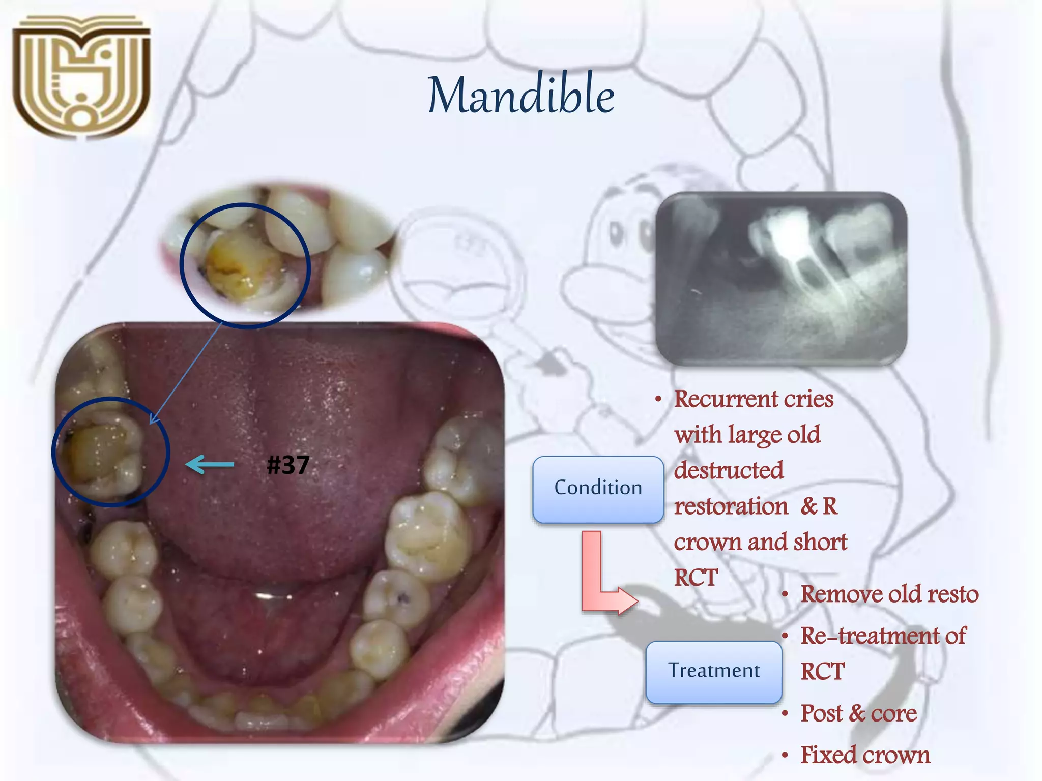 Comprehensive case , dental treatment. | PPTX