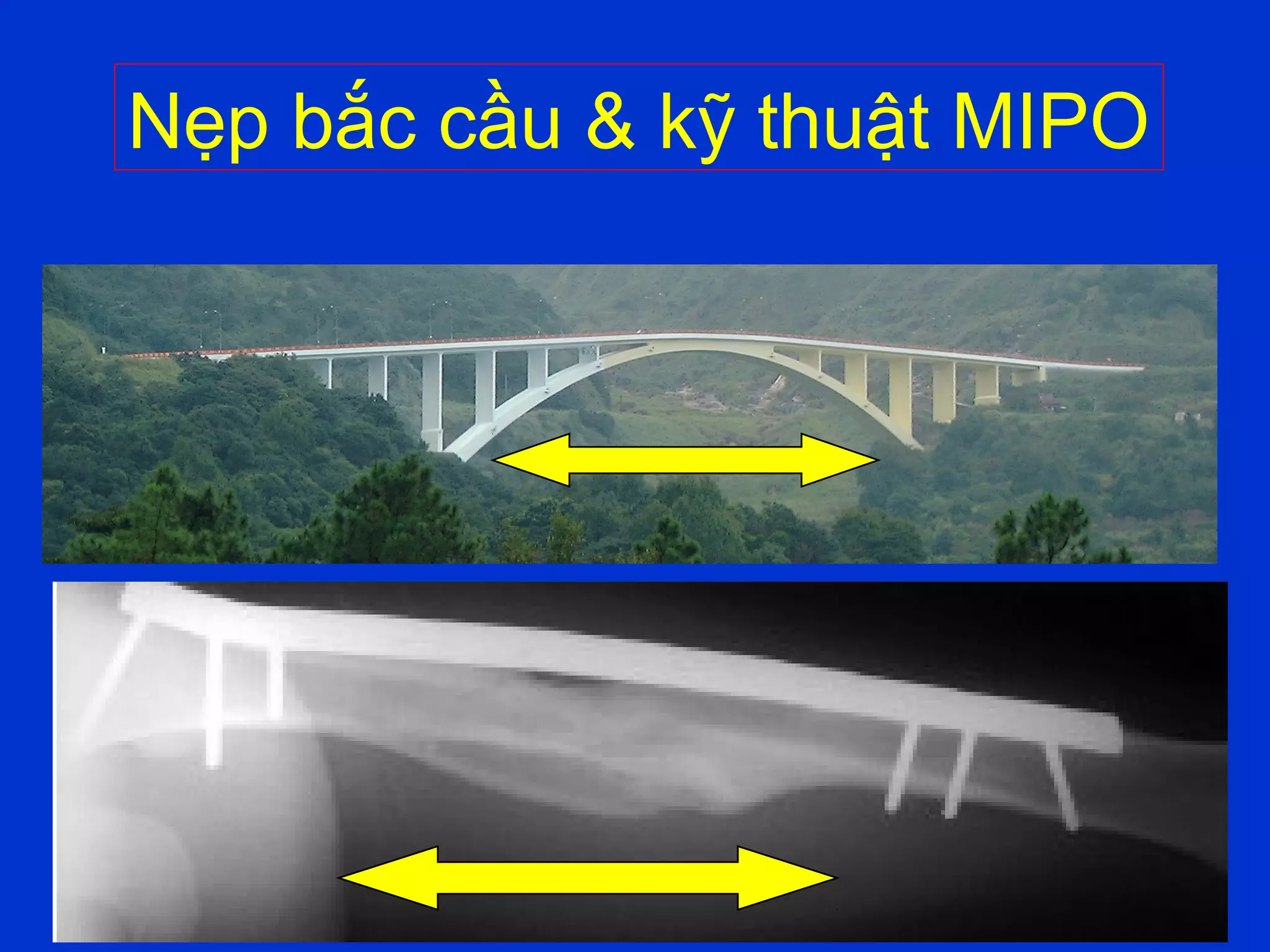 11. bridge plate and mipo tech v nese | PPT