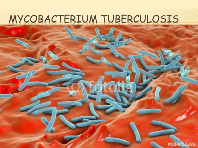 11. mycobacterium | PPTX