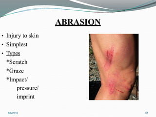 11.02.16 examination of a injured person-converted | PPTX