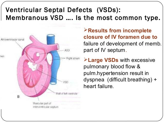 11 development of the heart