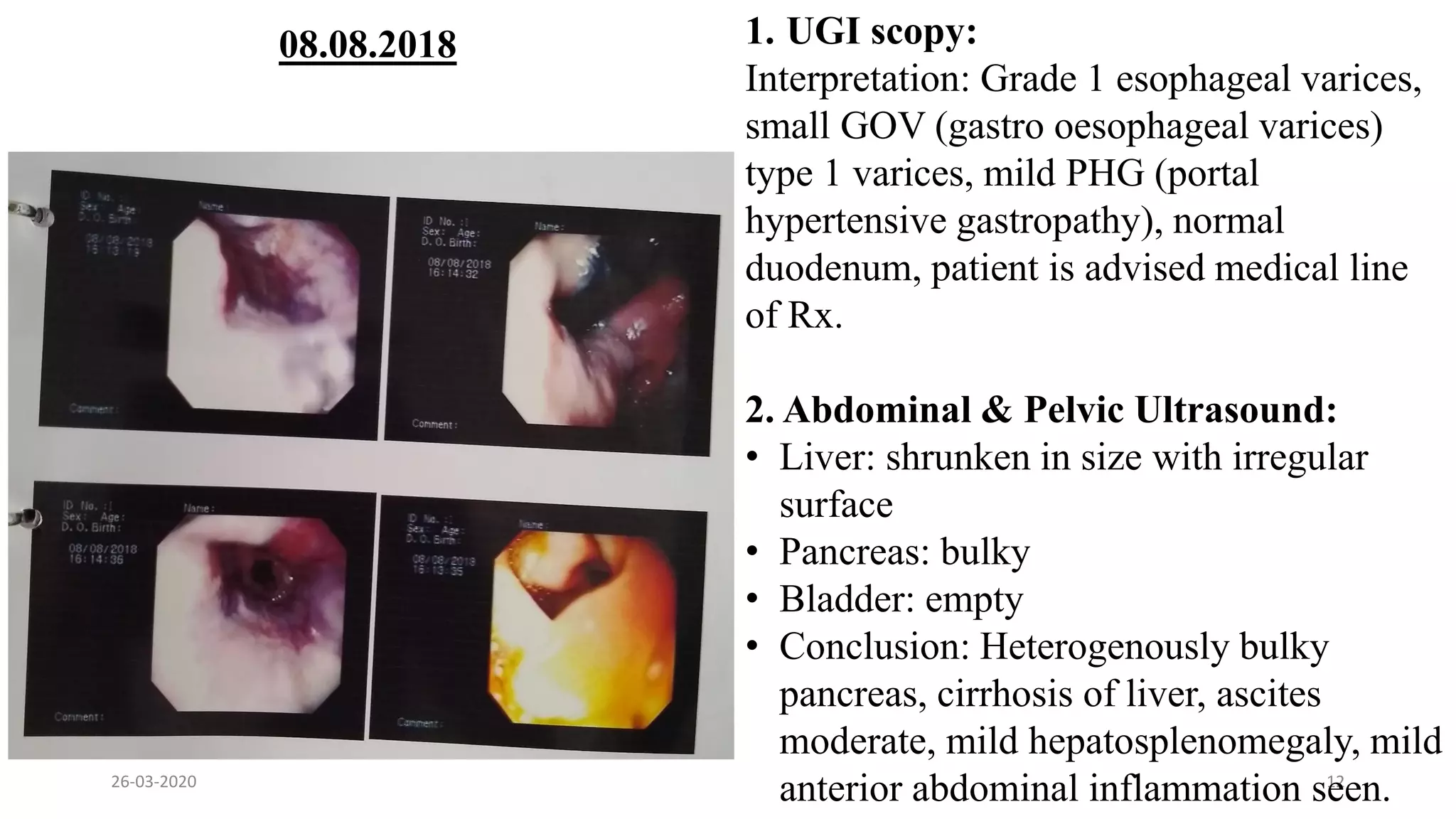 11. a case study on chronic alcoholic liver disease | PDF