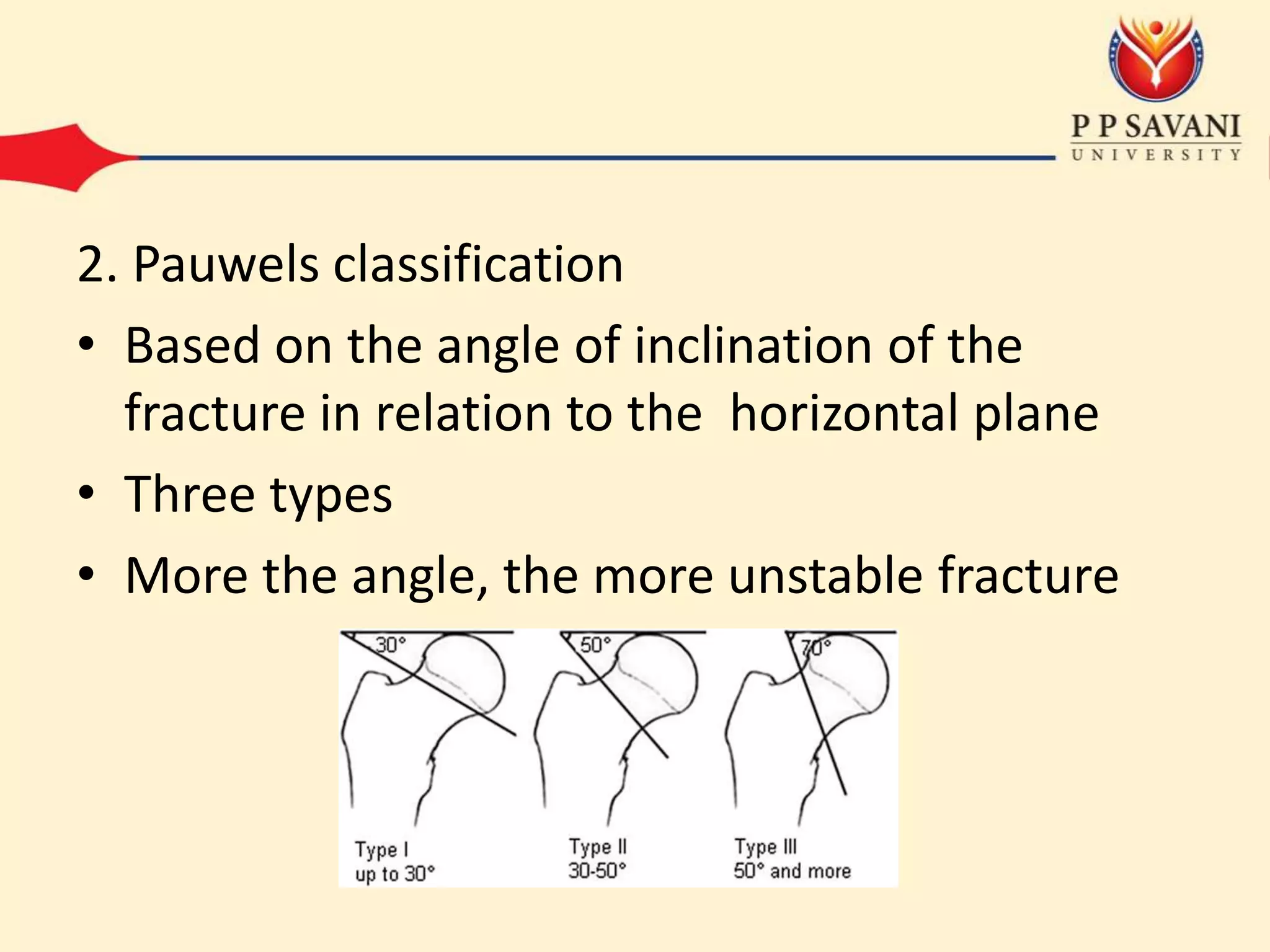 11. Hip dislocation | PPTX