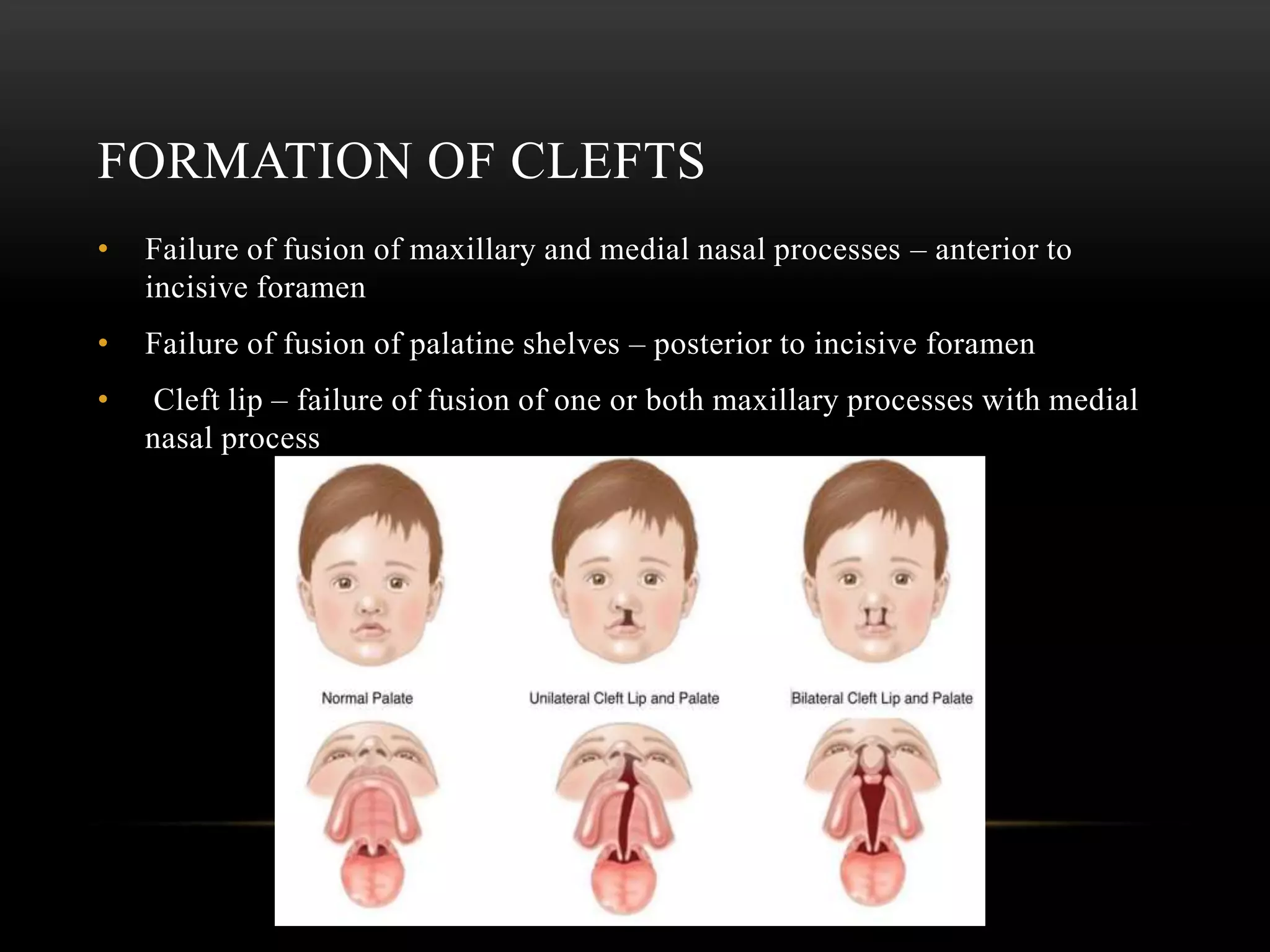 Cleft lip and palate rehabilitation - Dr Prathibha Prasad | PPTX | Pregnancy | Reproductive Health