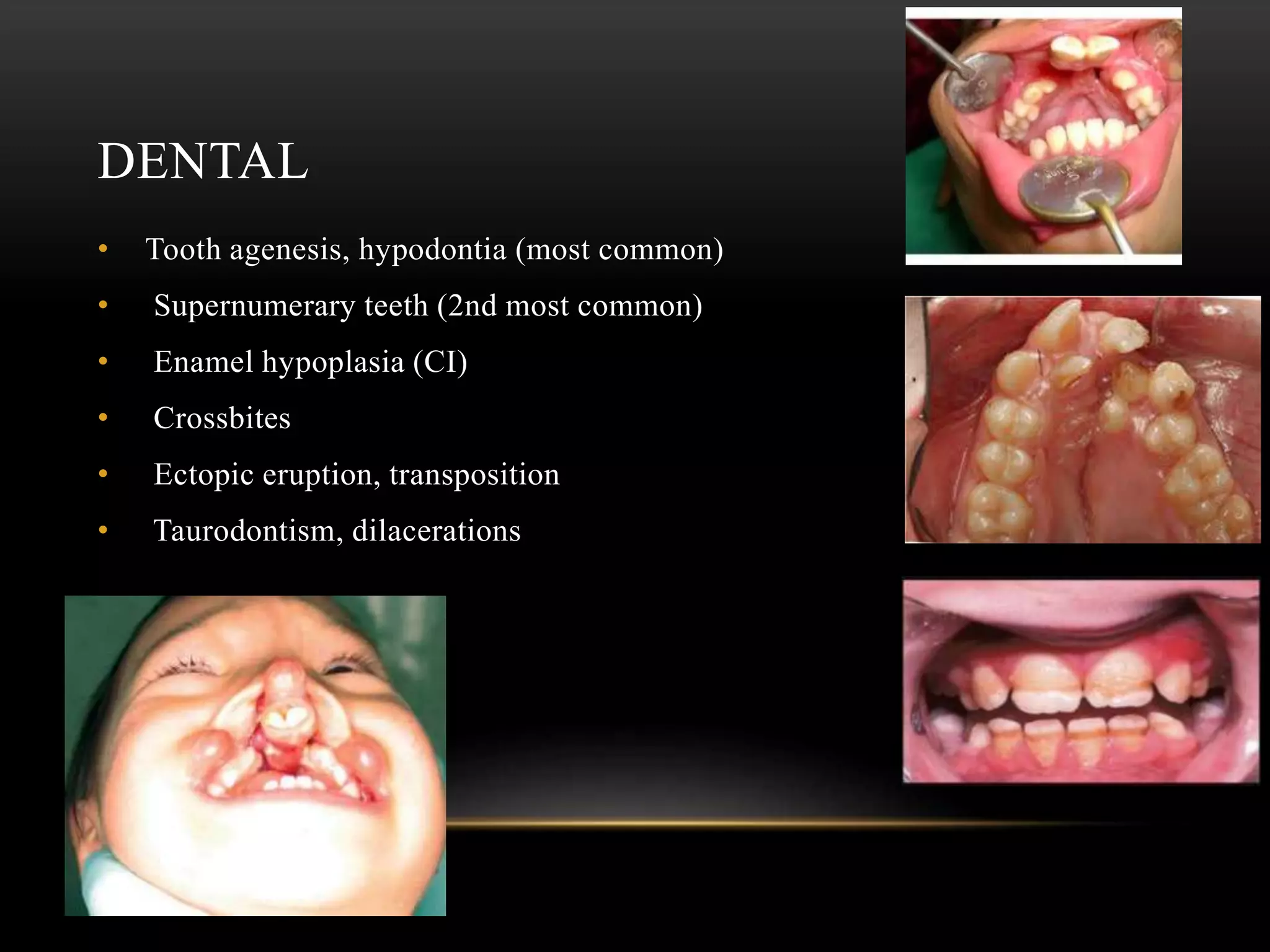 Cleft lip and palate rehabilitation - Dr Prathibha Prasad | PPTX